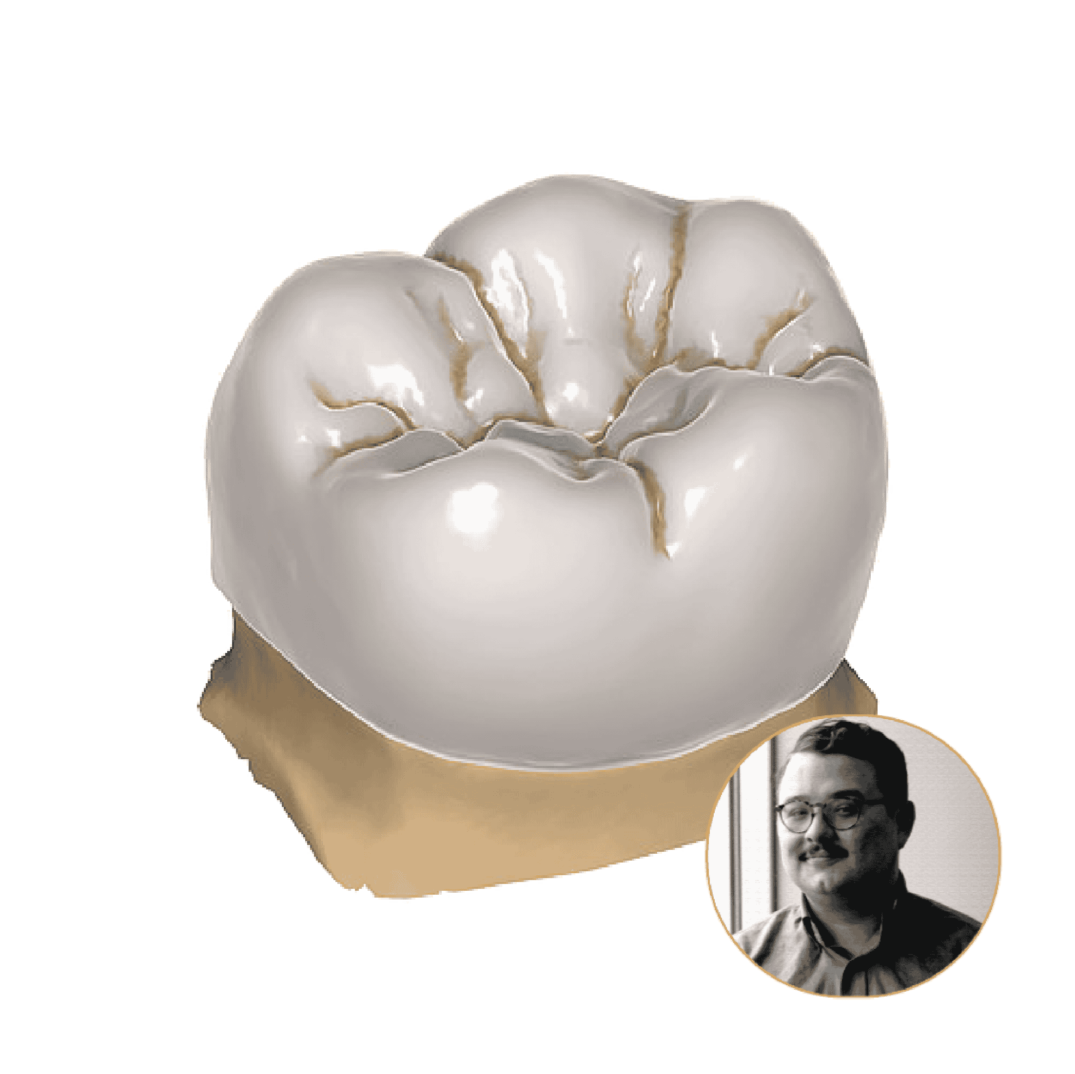 Crown Design | Evolve Dentistry