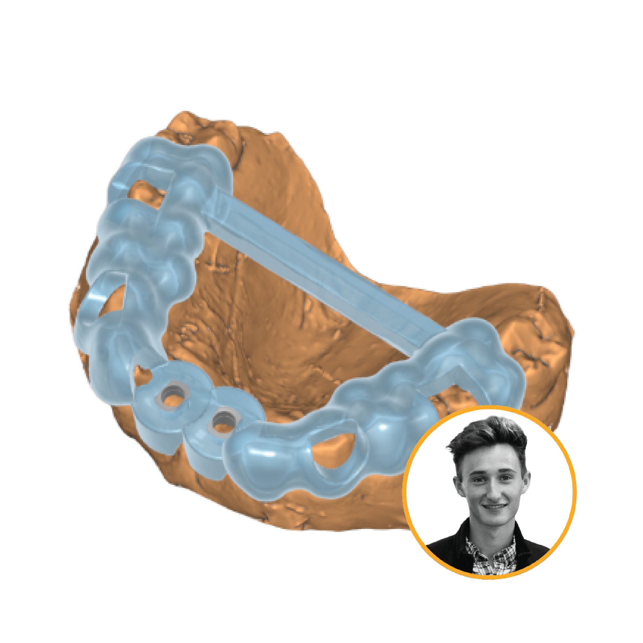 Surgical Guide Design | Evolve Dentistry