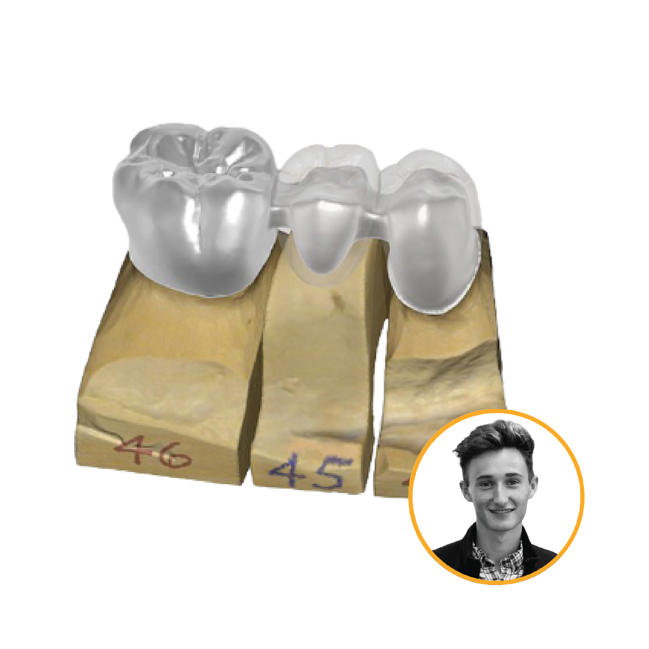 Bridge Design | Evolve Dentistry