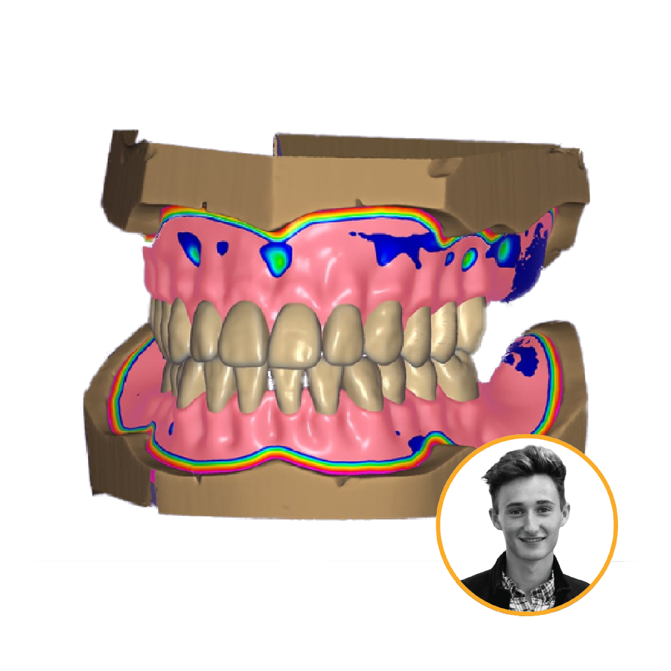 Denture Design | Evolve Dentistry