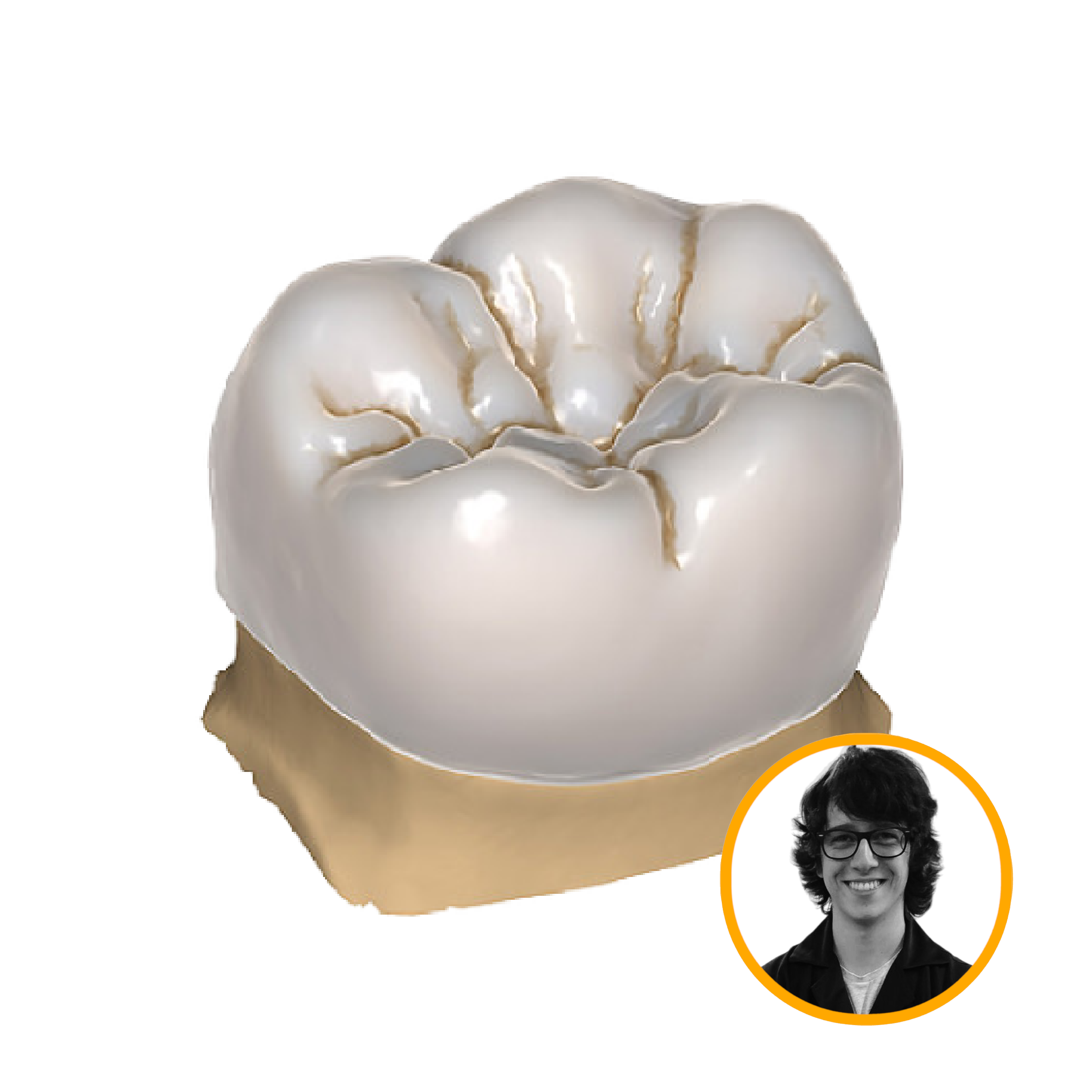 Crown Design | Evolve Dentistry