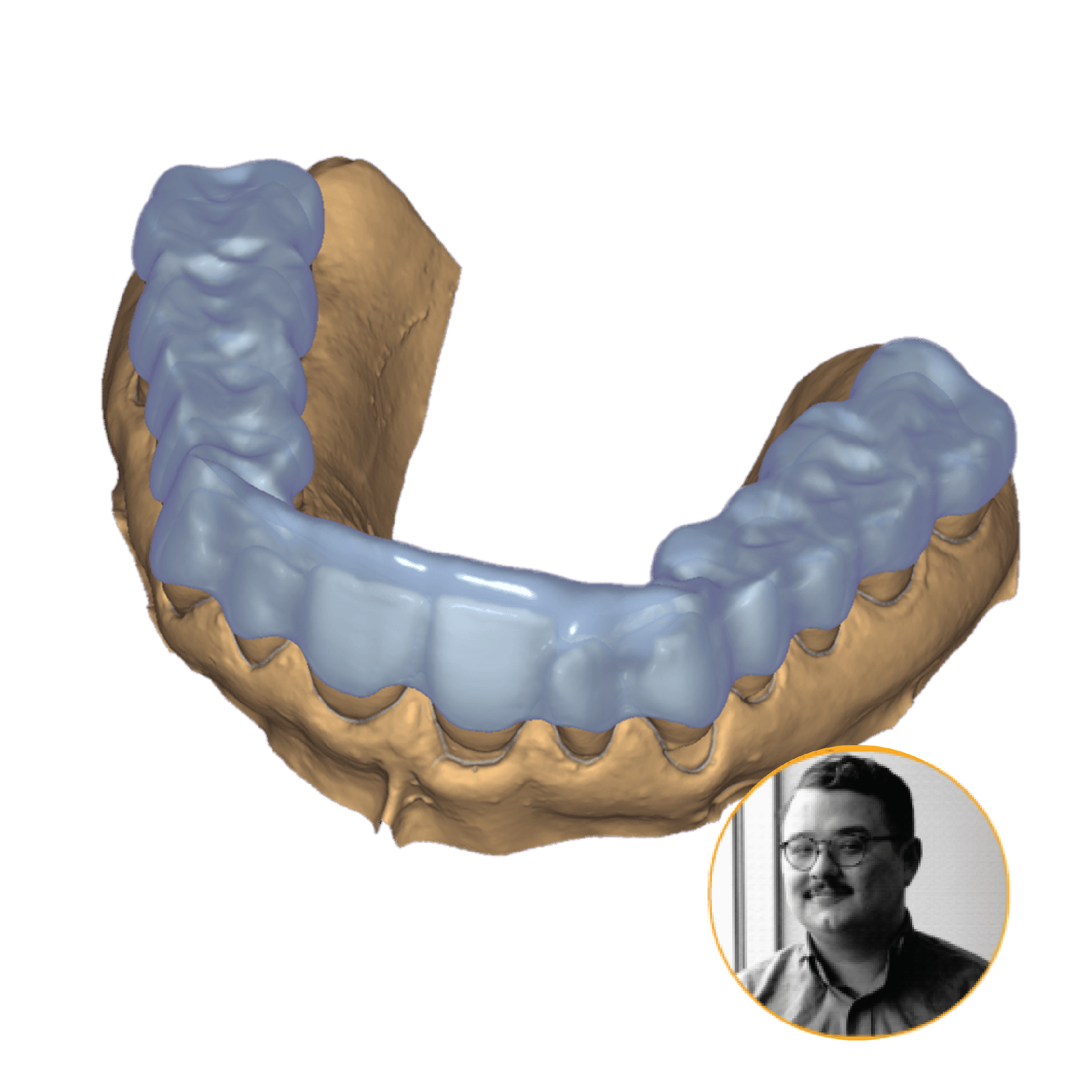 Bite Splint Design | Evolve Dentistry