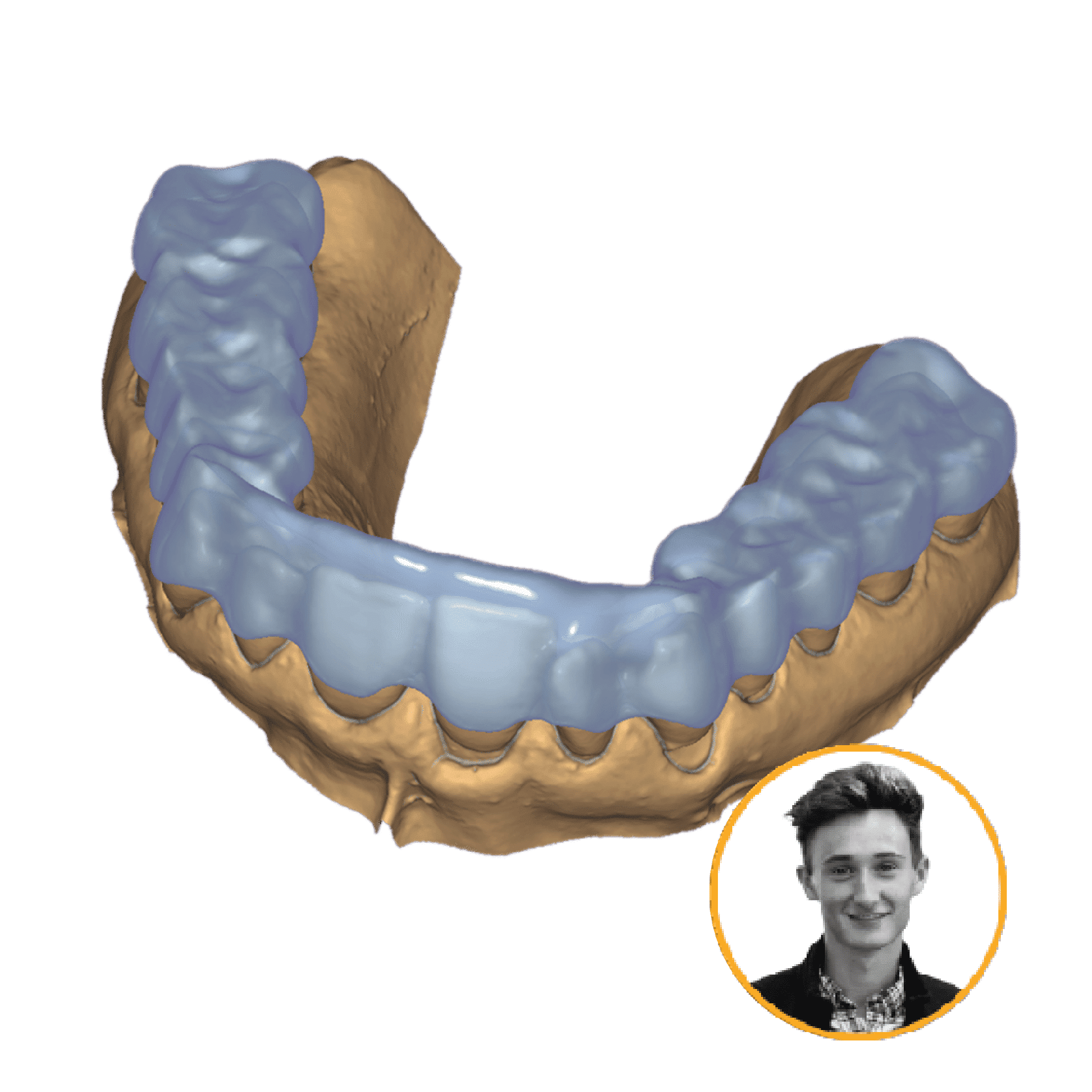 Bite Splint Design | Evolve Dentistry