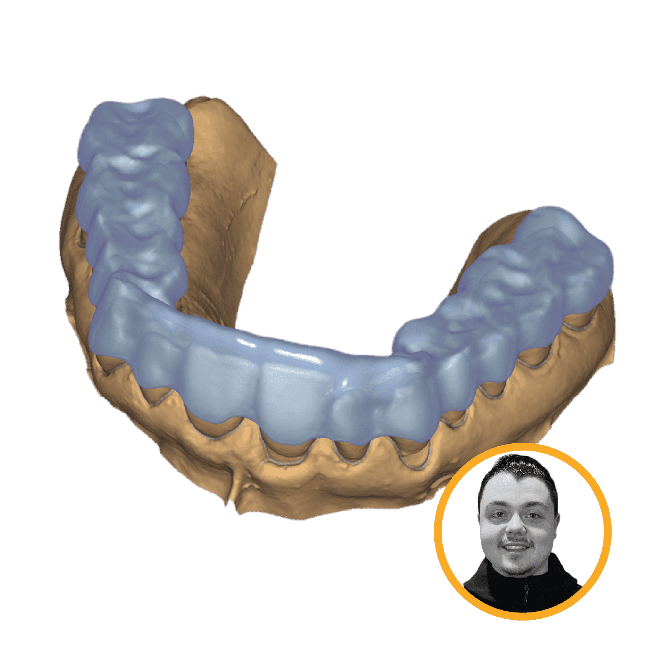 Bite Splint Design | Evolve Dentistry