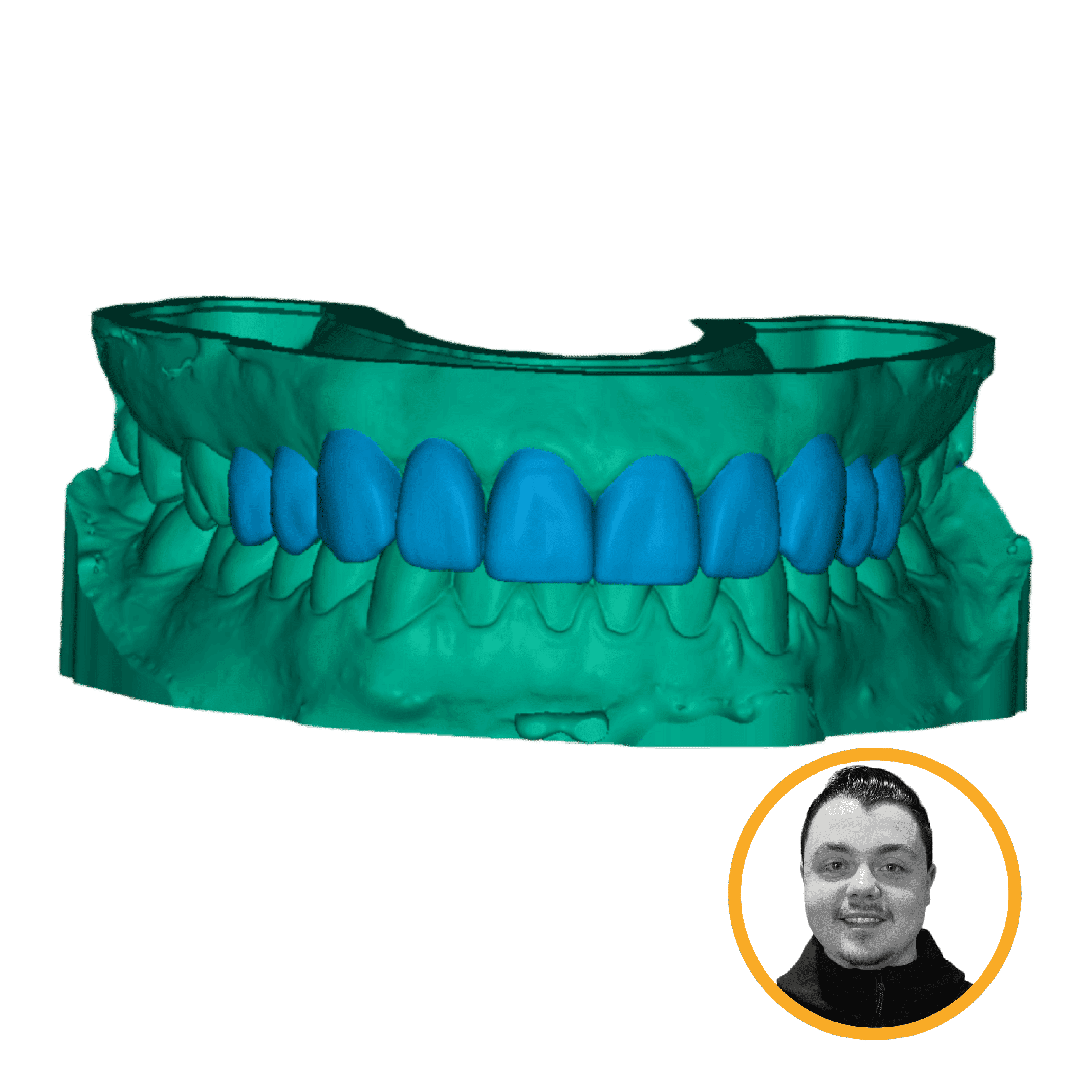 Wax Up Design | Evolve Dentistry