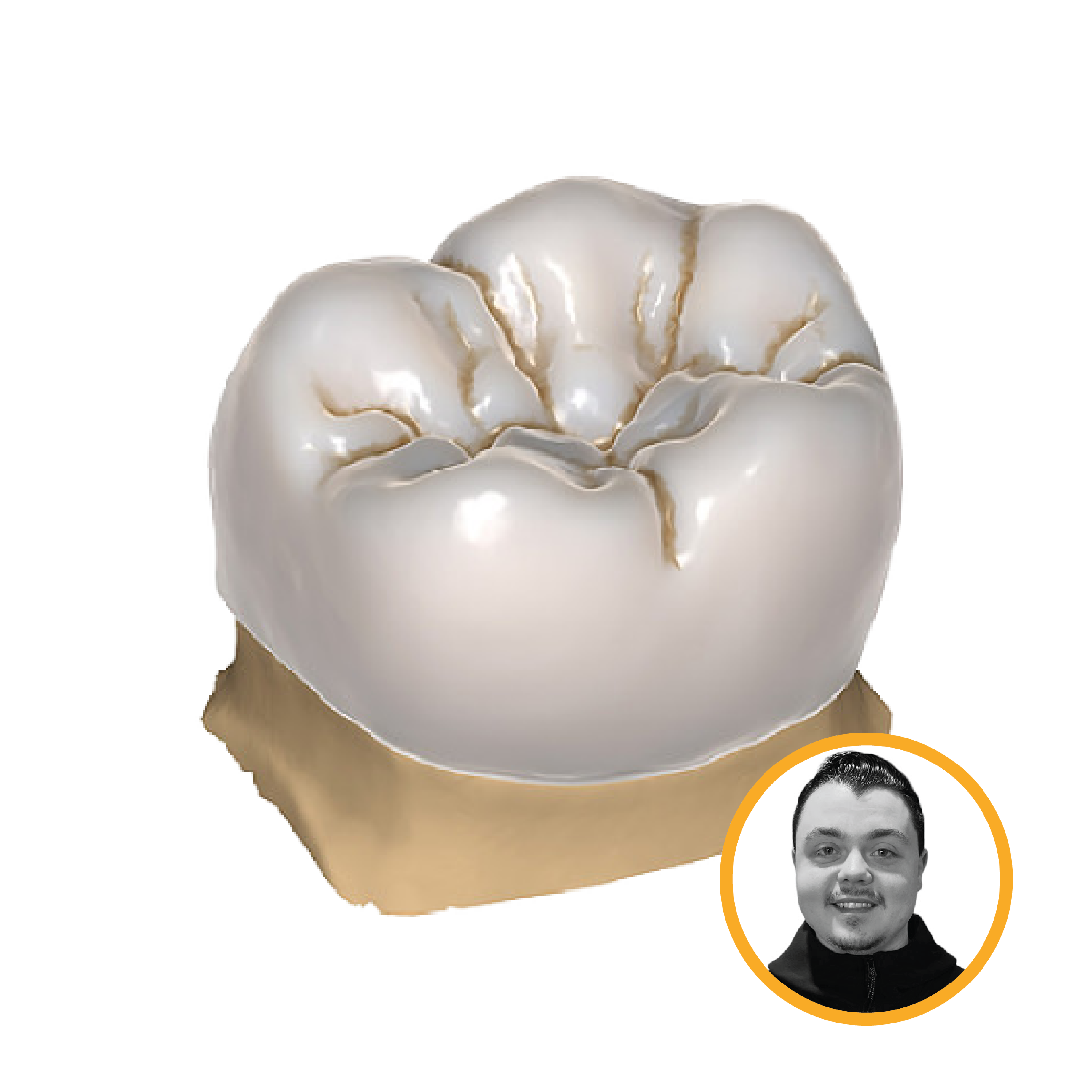 Crown Design | Evolve Dentistry