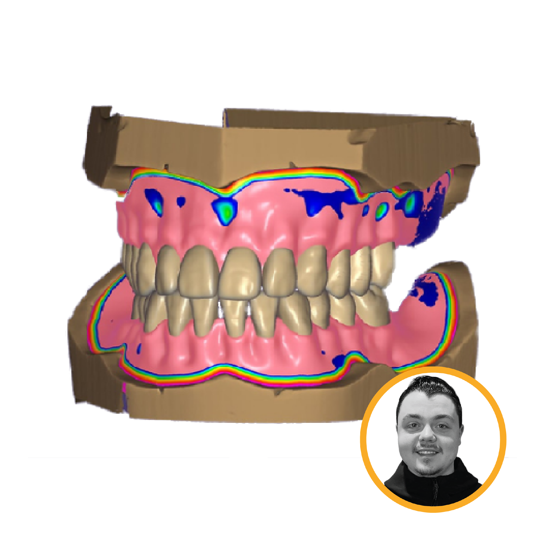 Denture Design | Evolve Dentistry
