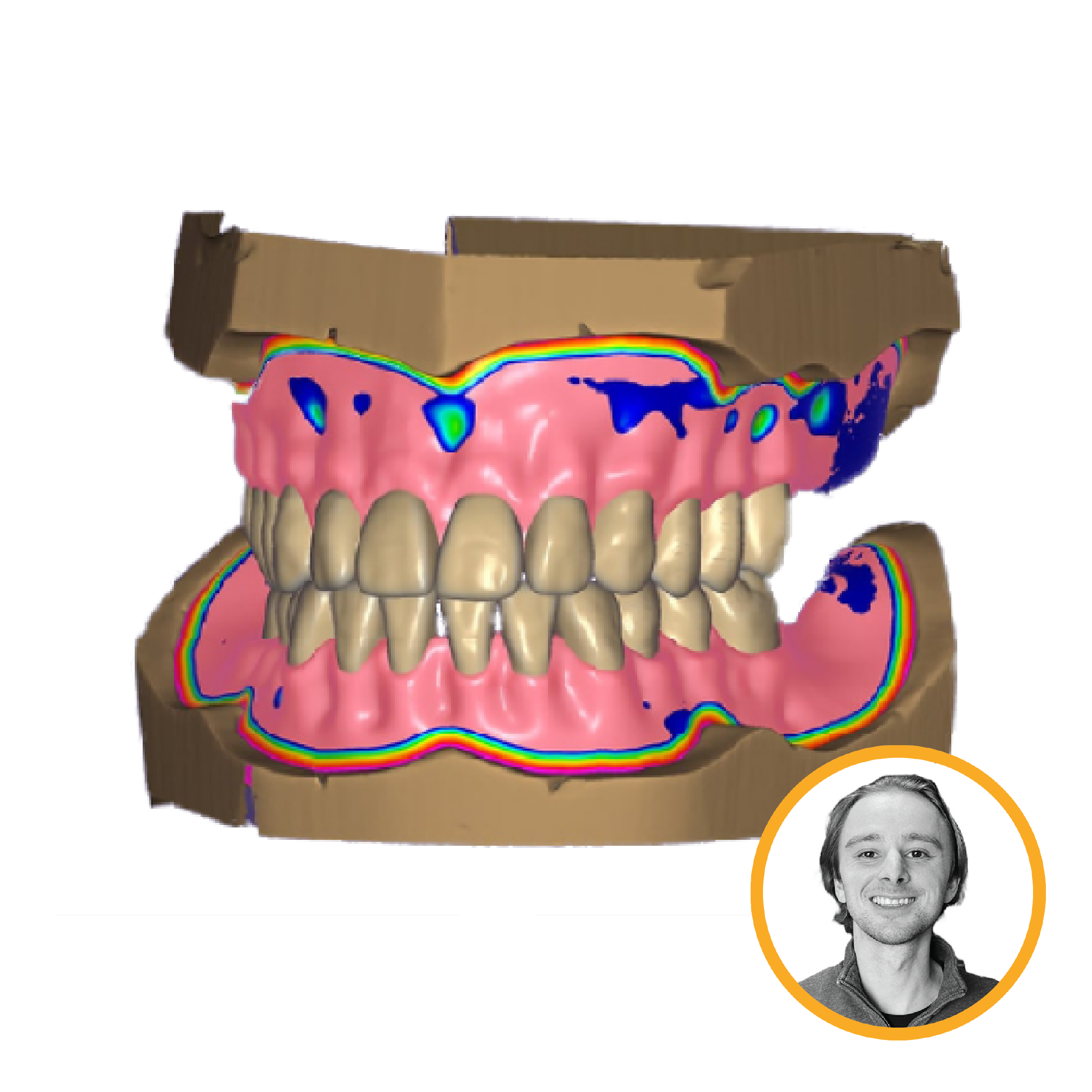 Denture Design | Evolve Dentistry