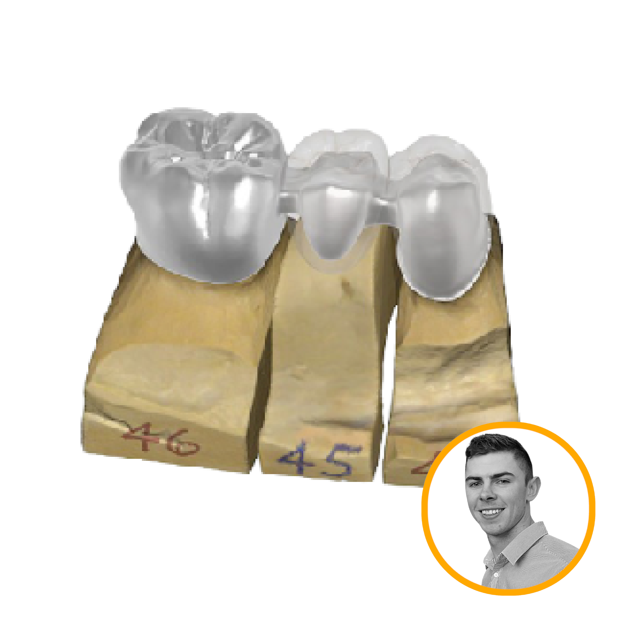 Bridge Design | Evolve Dentistry