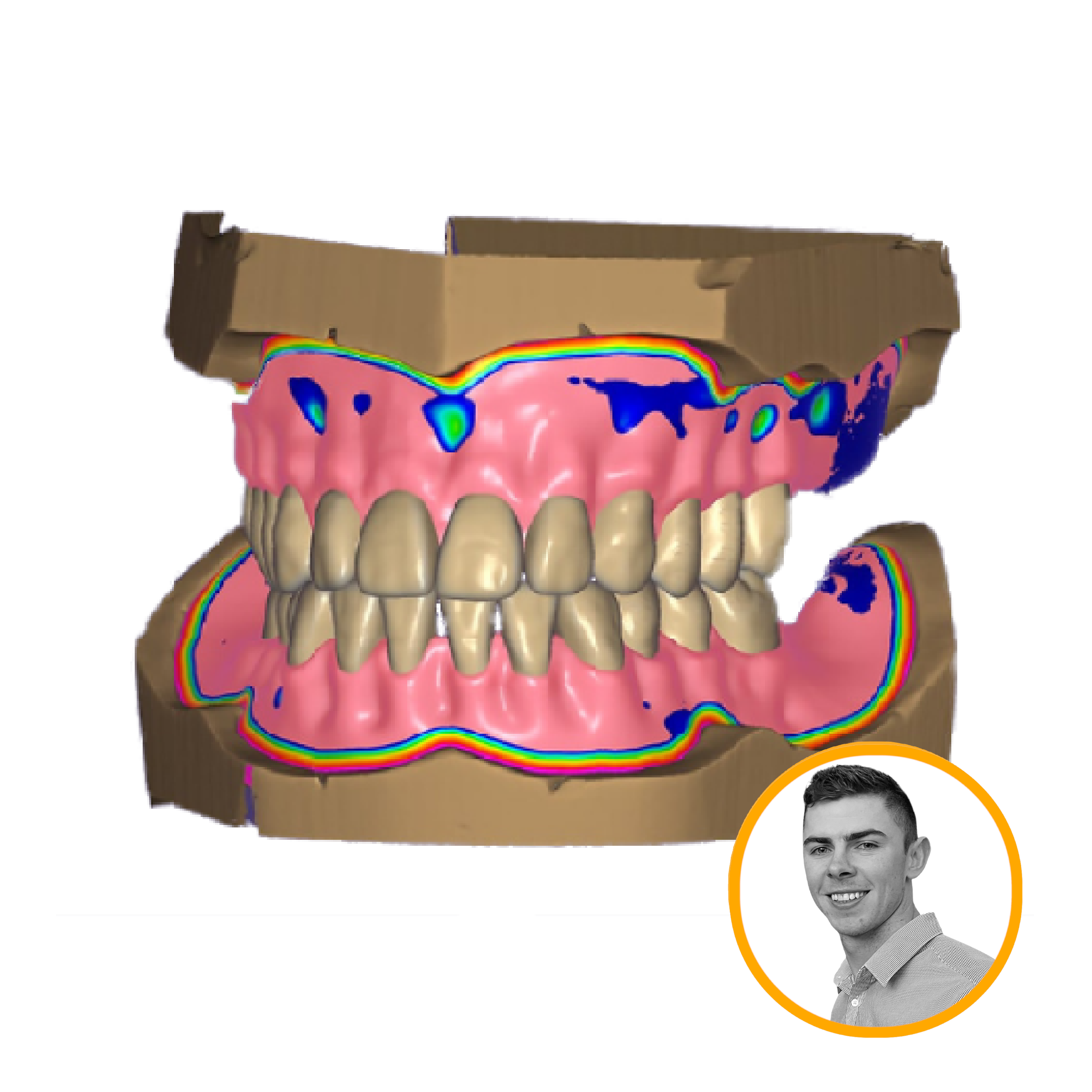 Denture Design | Evolve Dentistry
