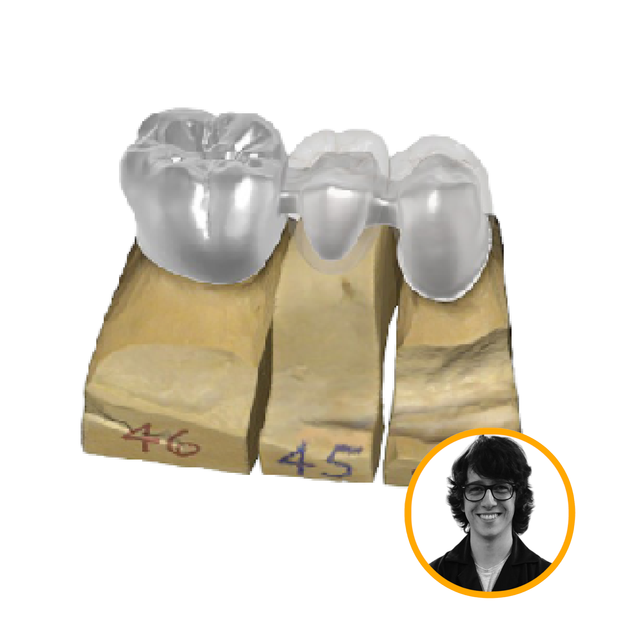 Bridge Design | Evolve Dentistry