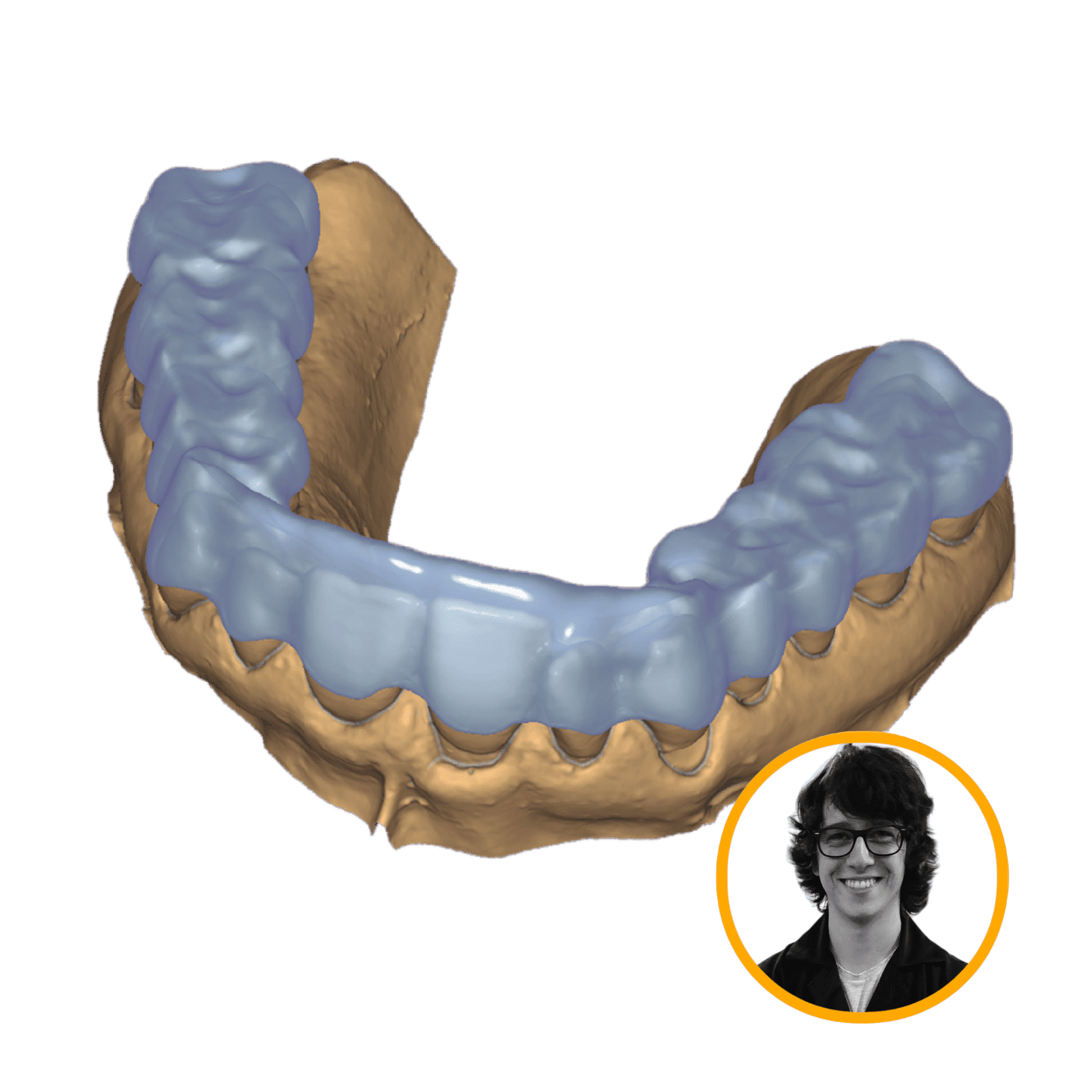 Bite Splint Design | Evolve Dentistry