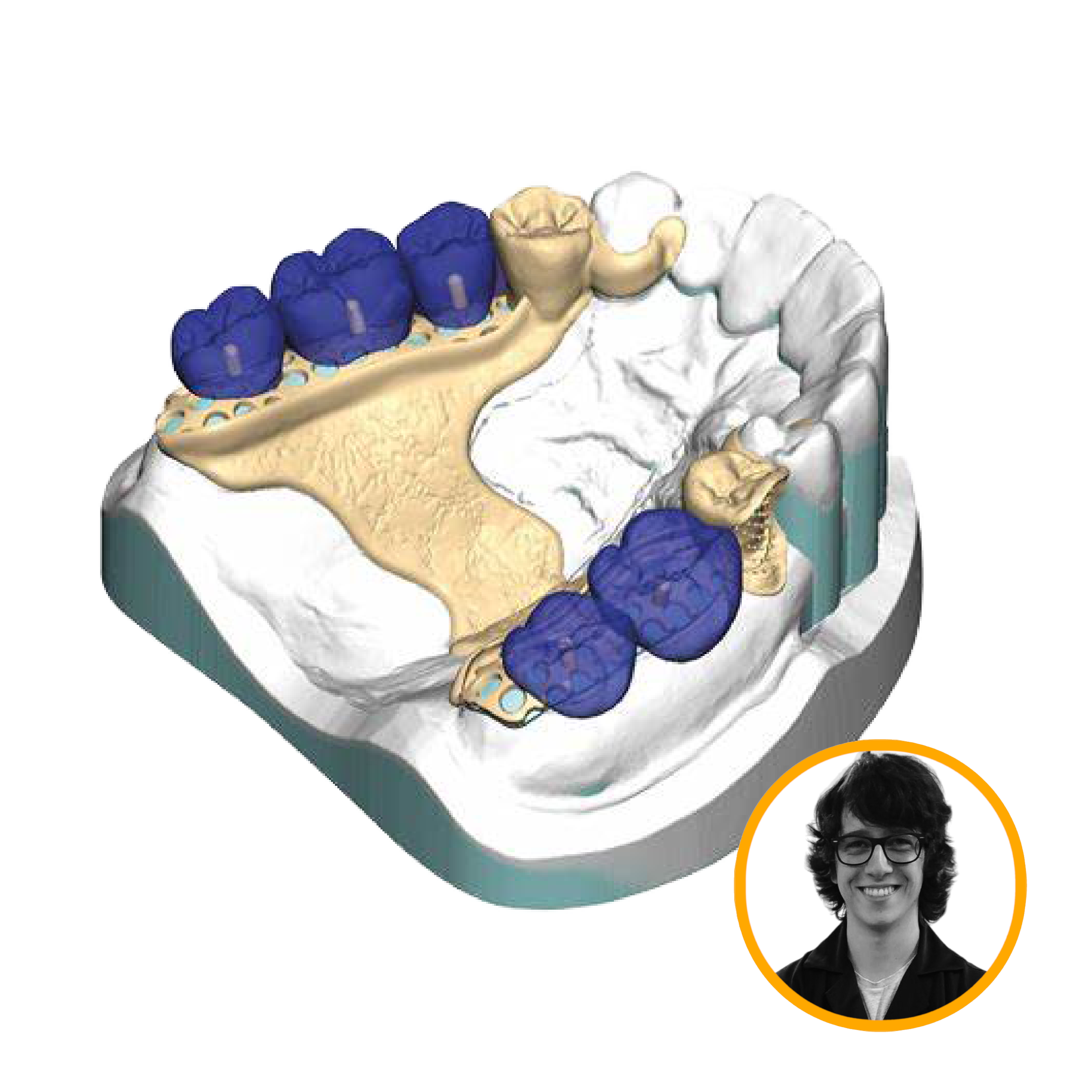 Partial Denture | Evolve Dentistry