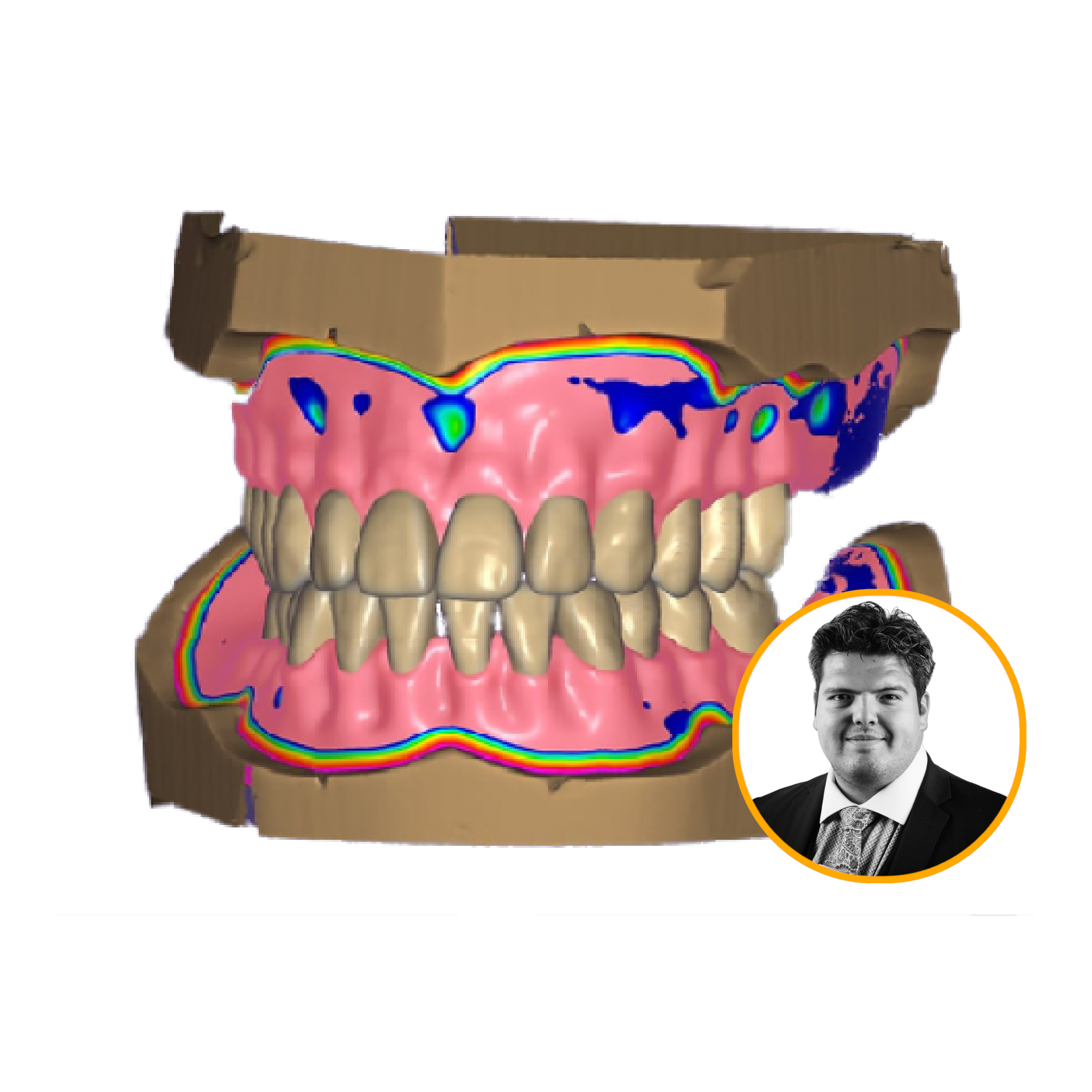 Denture Design | Evolve Dentistry