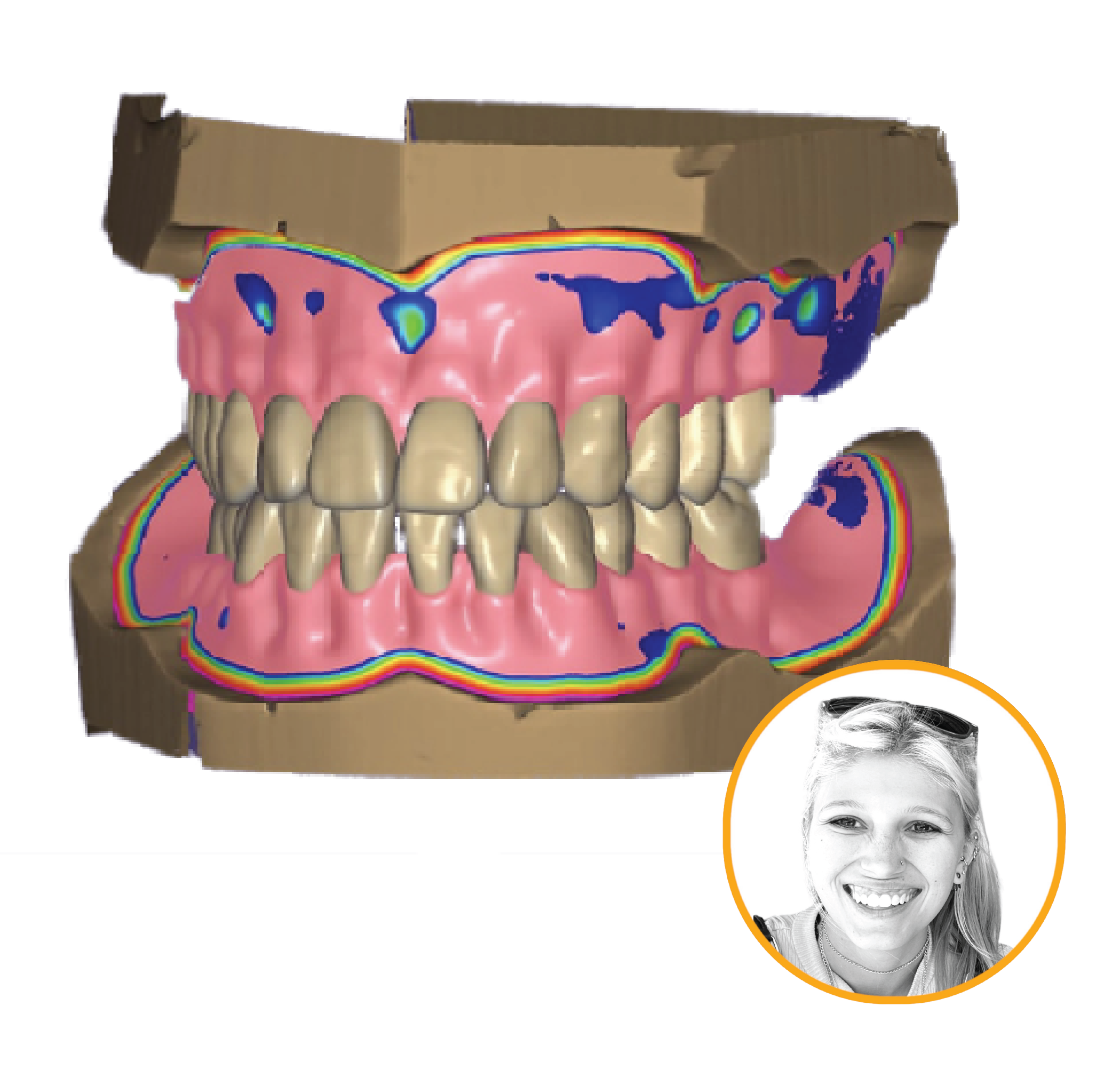 Denture Design | Evolve Dentistry