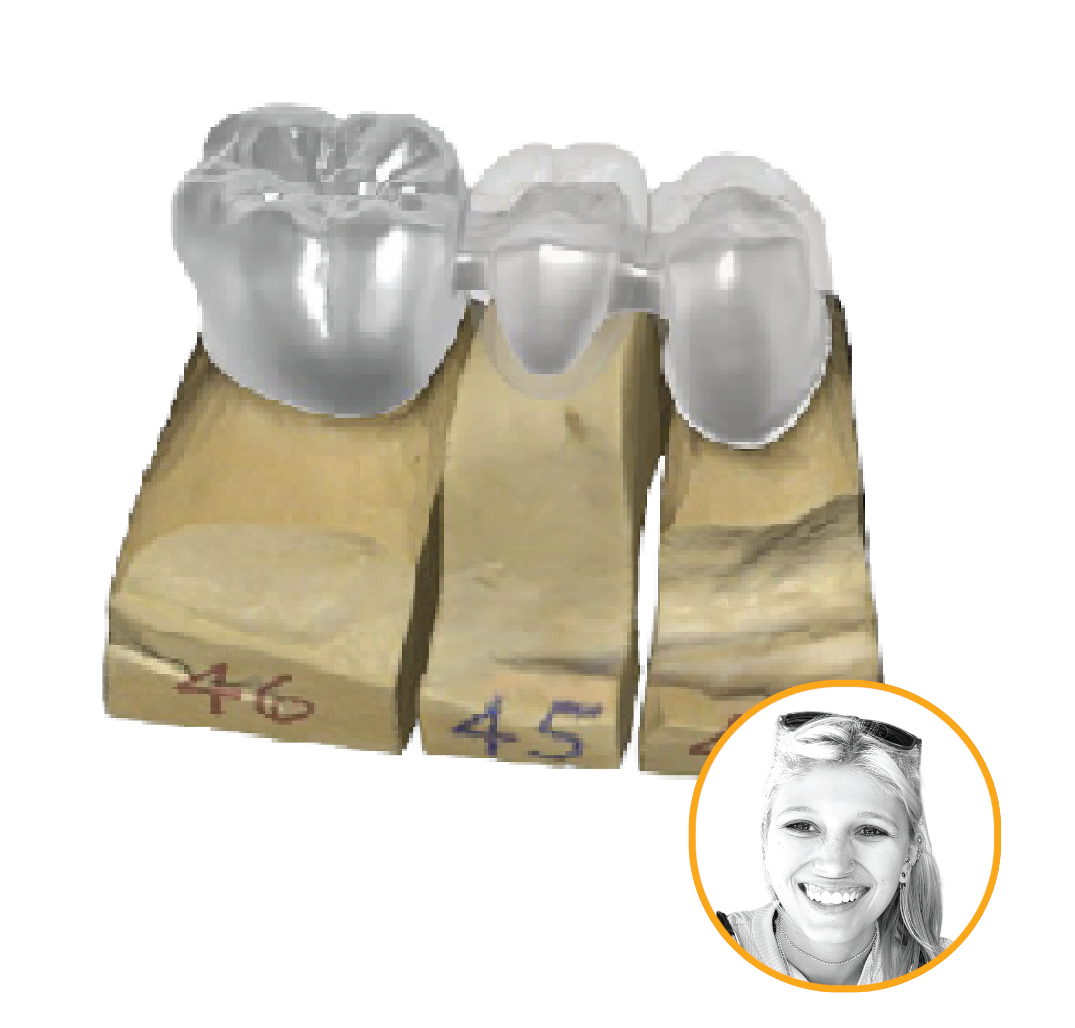 Bridge Design | Evolve Dentistry