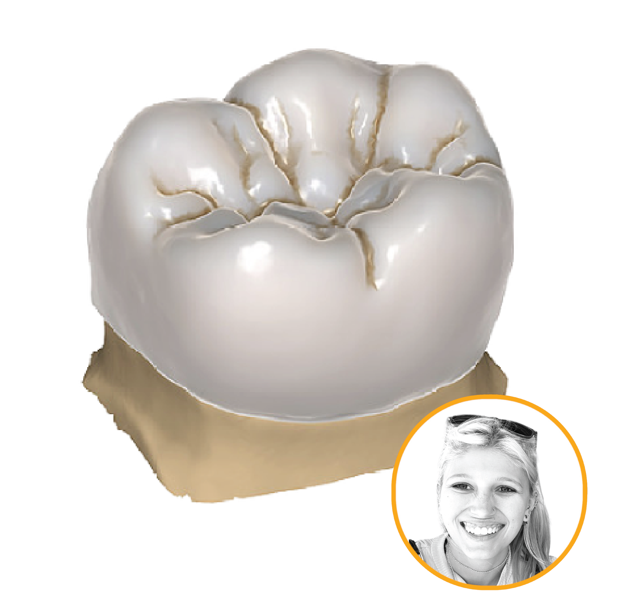 Crown Design | Evolve Dentistry